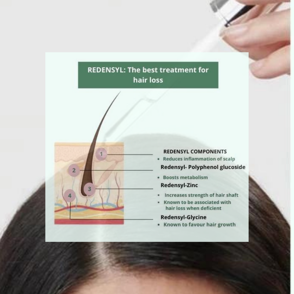 Best Treatment for Hair Loss | Hair Growth Serum | Redensyl |Hair Fall